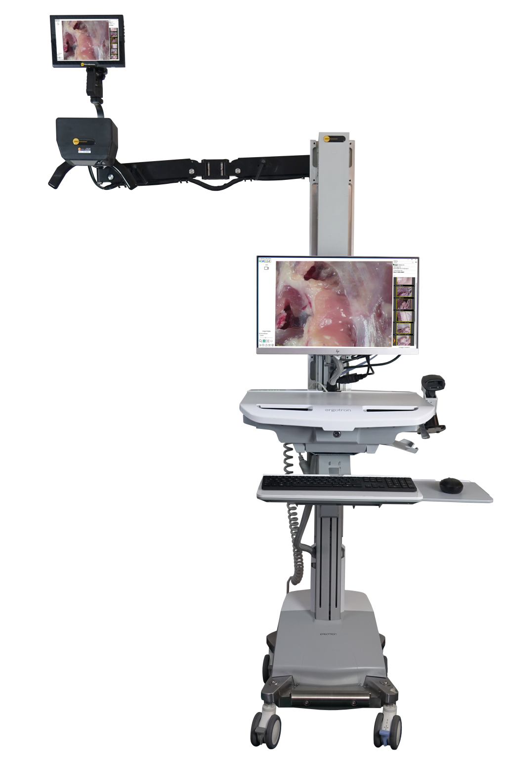Pathology Gross Imaging | Pathology Grossing Cameras | SPOT